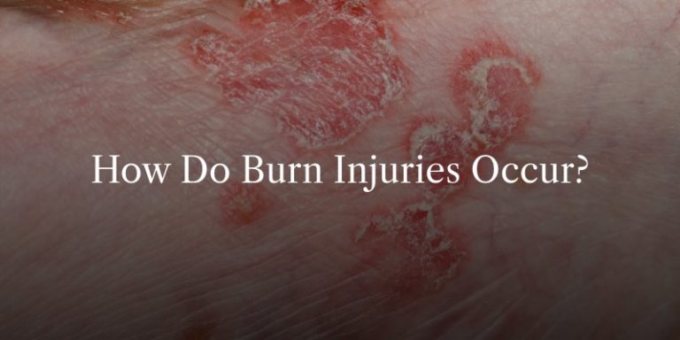 Common Causes of Burn Injuries
