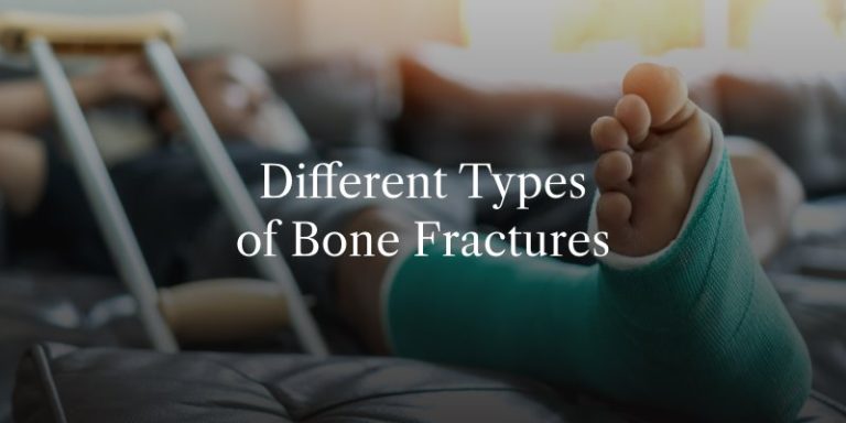 Different Types of Bone Fractures